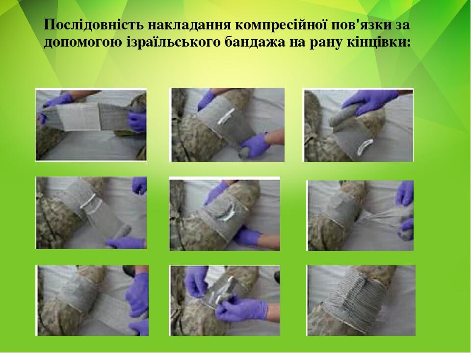 Презентація "Використання компресійної пов’язки " | Презентація. Захист ...